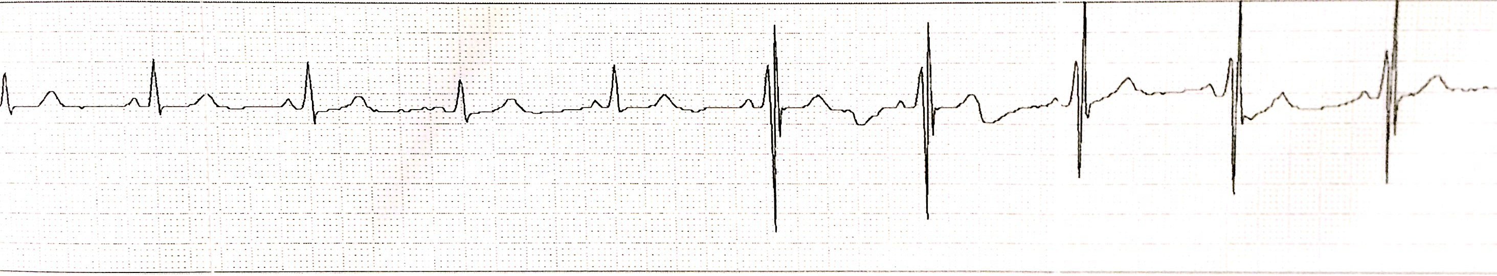 Recognising Congestive Heart Failure – STEAMindiaReports