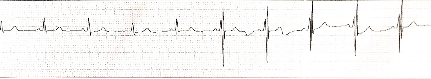 Recognising Congestive Heart Failure – STEAMindiaReports